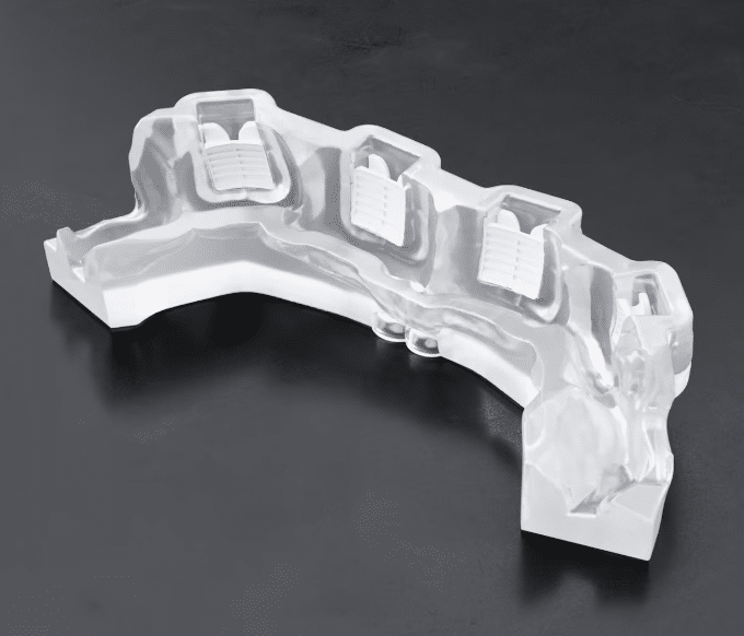 LightForce Custom Braces Closter NJ | Smile Story Orthodontics